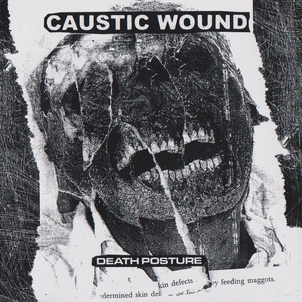 Buy Caustic Wound : Death Posture (Album) Online for a great price ...